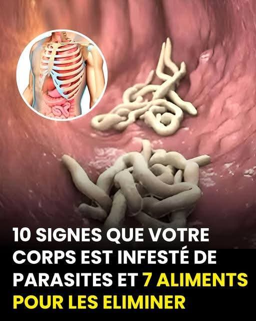 Parasites intestinaux : 10 signes révélateurs et solutions naturelles ...