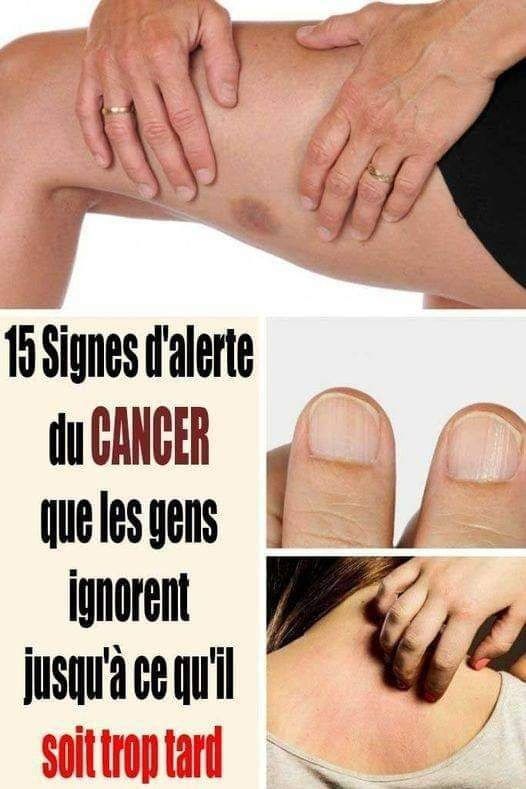 15 Signes Précoces de Cancer que Vous ne Devez Jamais Ignorer ...